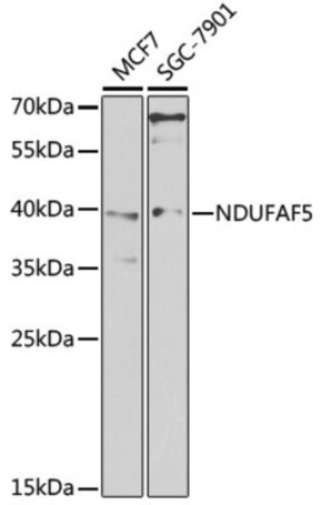 NDUFAF5 Rabbit anti-Human, Mouse, Rat, Polyclonal, Novus Biologicals 100 | Fisher Scientific